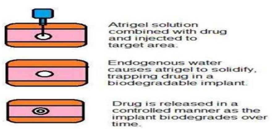 (PDF) A REVIEW ON ATRIGEL: A NOVEL DRUG DELIVERY SYSTEM FORMING IMPLANTS