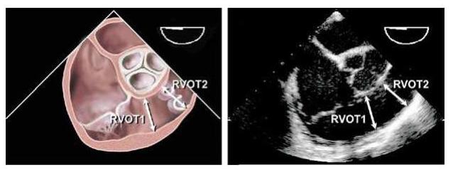 (PDF) Recommendations for Chamber Quantification: A Report from the ...