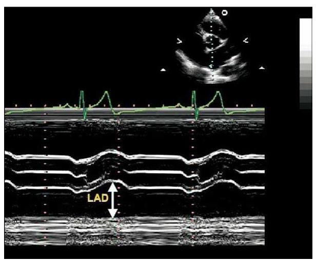 (PDF) Recommendations for Chamber Quantification: A Report from the ...