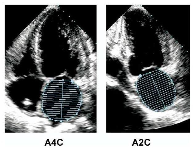 (PDF) Recommendations for Chamber Quantification: A Report from the ...