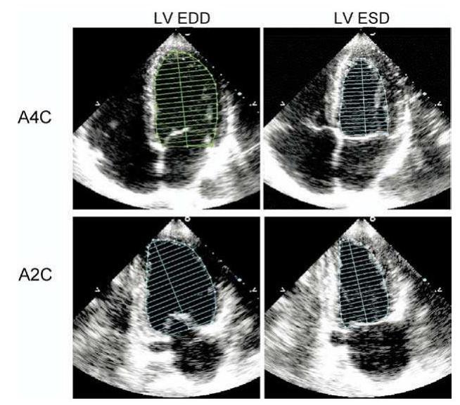 (PDF) Recommendations for Chamber Quantification: A Report from the ...