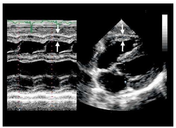 (PDF) Recommendations for Chamber Quantification: A Report from the ...