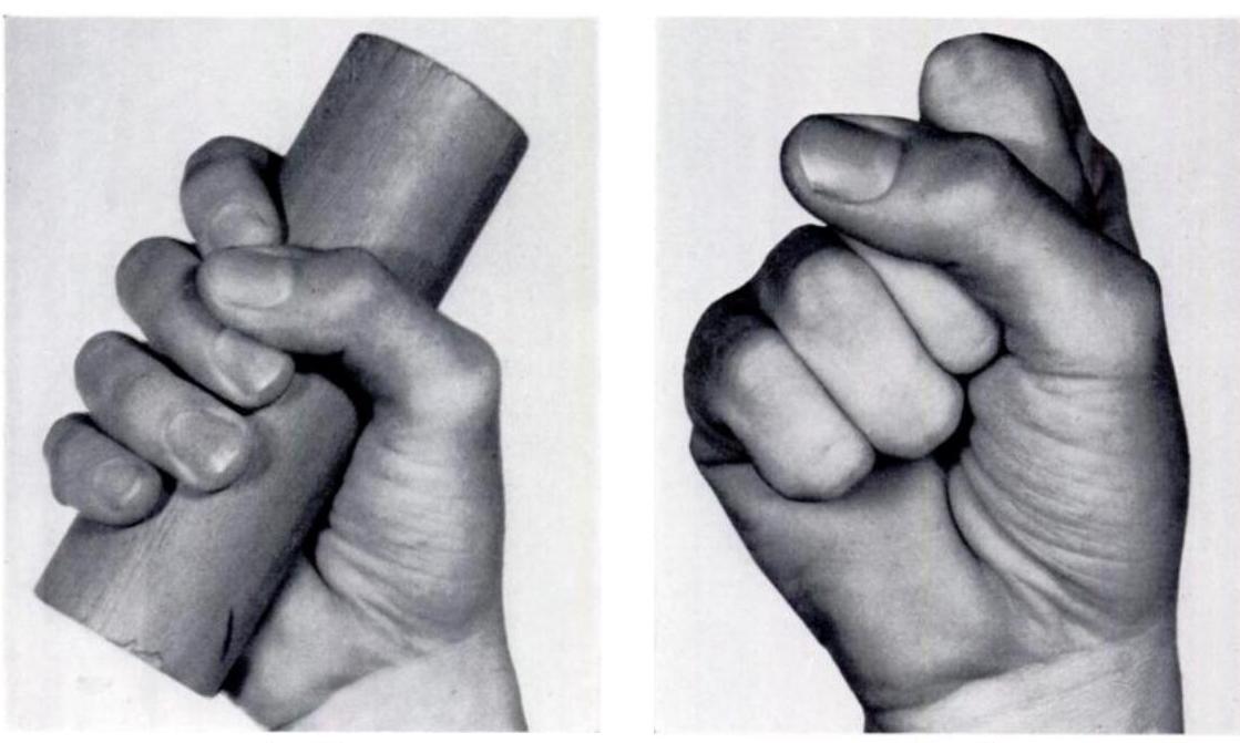 (PDF) The prehensile movements of the human hand